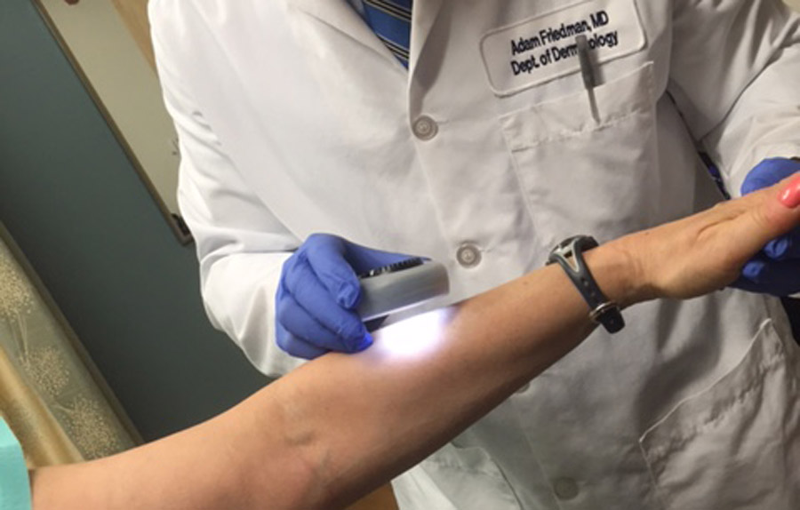 Simple skin cancer check that few people do - WTOP News