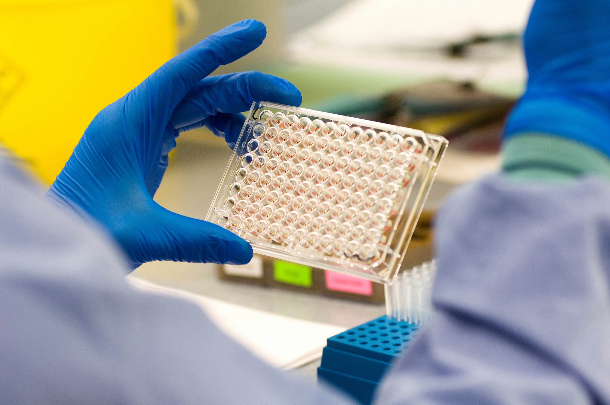 Stock of Vienna-based Cel-Sci tumbles on FDA notice - WTOP News