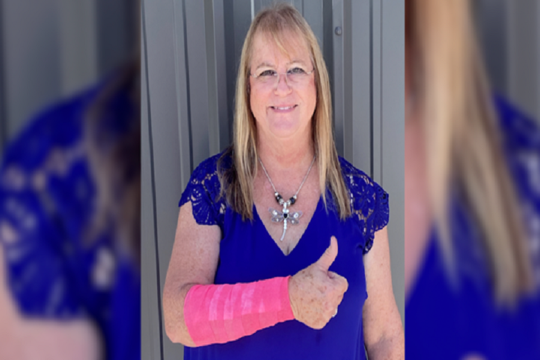 Texas woman says she was attacked by snake and hawk at same time - WTOP ...
